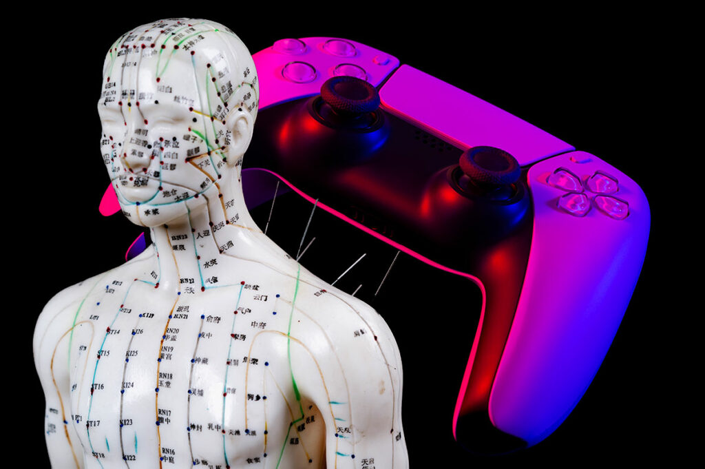 Can Acupuncture Help Your Video Game Addiction Recovery? - Game Quitters
